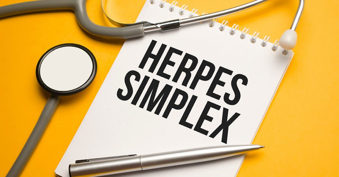 Herpes simplex